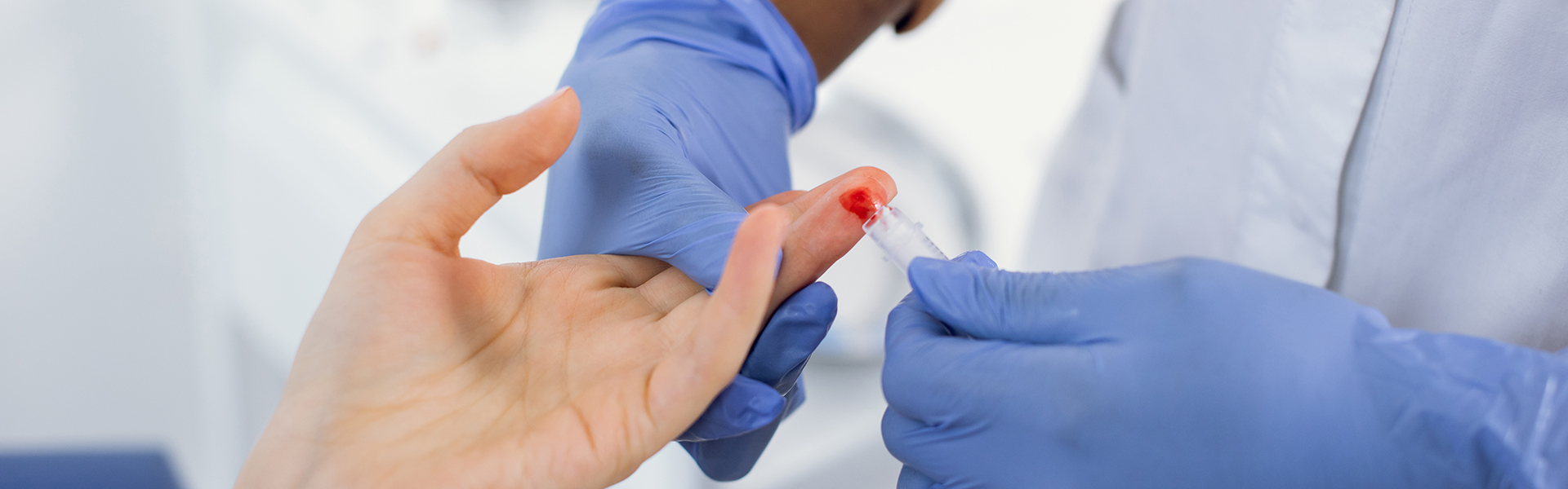 HIV AIDS PEP & PrEP Test Kit KL - Treatment & Medication